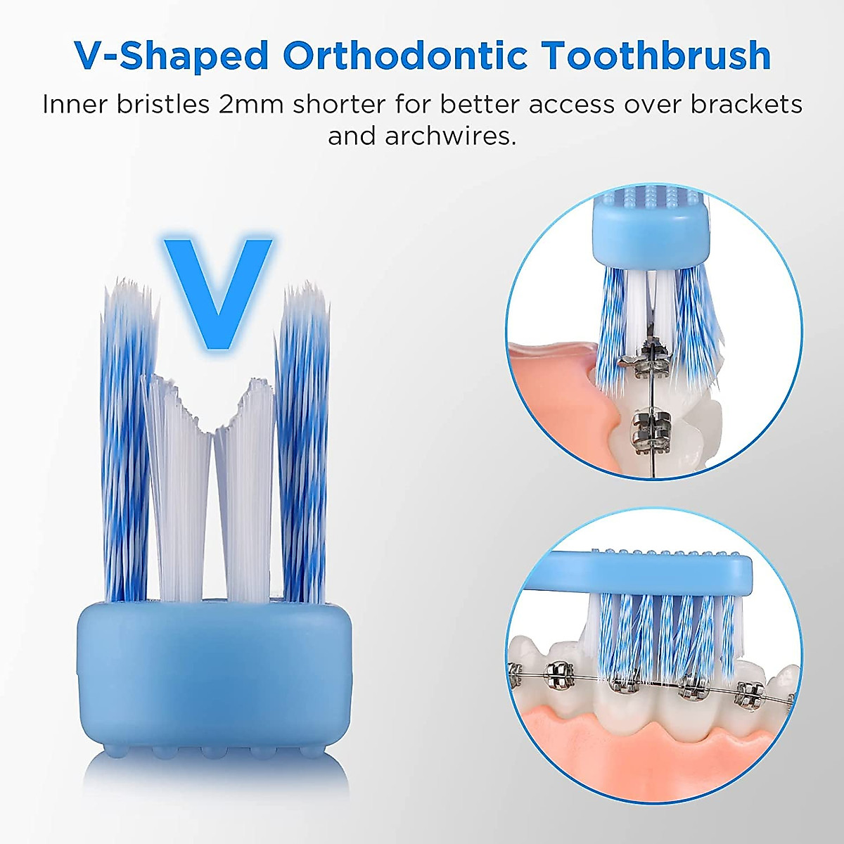 Fremouth V-Shaped Orthodontic Toothbrush for Braces, Soft Bristles, 6 Count, with Interdental Brushes