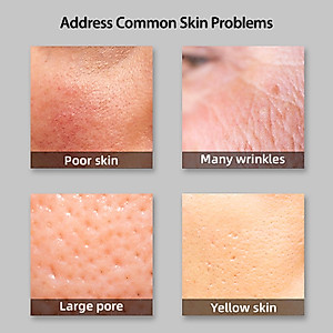 Prolux LED Red Light Therapy Face Mask - Near Infrared Light Therapy For Face - Lightweight Flexible LED Face Mask for Skin Rejuvenation & Wrinkle Reduction