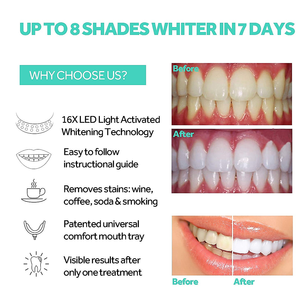 Teeth Whitening Accelerator Light, 16x More Powerful Blue LED Light, Mouth Tray Teeth Whitening Enhancer Light Trays Connected with iPhone/Micro-USB Android/USB for Home Use