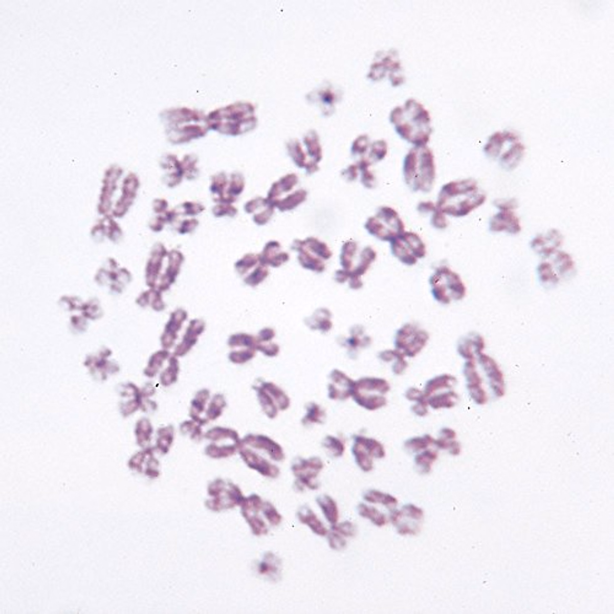 Human Female Chromosomes - 46, XX, Spread Microscope Slide