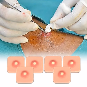 Ultrassist Abscess I&D Incision and Drainage Pad (6-Pack), Sebaceous Cyst Removal Trainer, Suture Practice Skin Pad for Medical Education