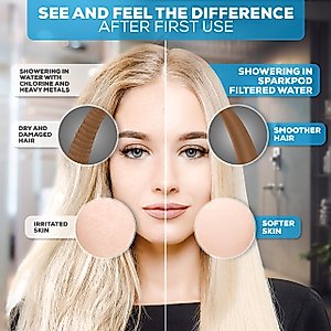 SparkPod High Output Shower Filter Capsule - Suitable for People with Sensitive and Dry Skin and Scalp, Filters Chlorine and Impurities | 1-min install (Midnight Black Matte)