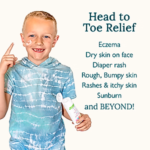 Baby and Kids Moisturizing Cream for Sensitive Skin Multi Purpose for Eczema Psoriasis Rosacea Dermatitis Rash, Healing Therapy for Dry Cracked Irritated Itchy Skin