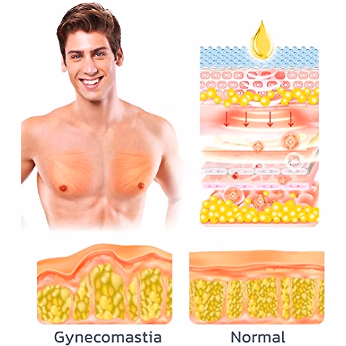 100ml Gynecomastia Tightening Cream,Gynekomastie Reduction Massage Oil,Gynecomastia Tightening Cream,Chest Reduction Massage Oil,Breast Reduction and Tightening Cream (2pcs)