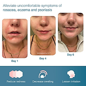 DERMAFACS RecoverX - Advanced Skin Repair Treatment - Silicon Based HSX Formula - Improve Damaged Skin