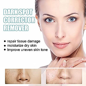 Dark Spot Remover Cream for Face, Dark Spot Cream, The Spot Cream for Face, Skin Spot Remover Cream, Dark Spot Correct Cream, Take Effect Quickly (5pcs) (3pcs)