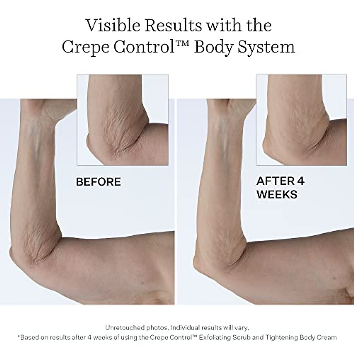 StriVectin Tighten & Lift Crepe Control Exfoliating Body Scrub, Targets Crepiness and Rough, Dull Skin, 5 Fl Oz, white