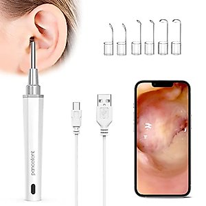 Pancellent Digital Otoscope Camera with Light, Ear Camera and Wax Remover, Video Ear Scope with Ear Wax Removal Tools, Compatible with iPhone, iPad, Android Smart Phone (Basic Edition White)