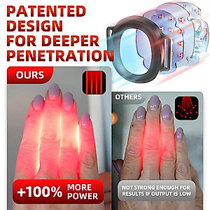 UTK Cold Laser Therapy Device for Dogs, Red Light Therapy for Dogs, Deeper Directly Targeted Pain Relief in Joint, Hip and ACL - Portable Infrared & Red Light with 660nm 850nm for Pets