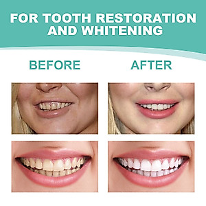 2 Pairs Snap on Dentures for Women with Missing Teeth, Veneers Snap in Teeth for Men, Comfort Confident Smile Cover The Imperfect Teeth