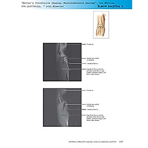 Netter's Correlative Imaging: Musculoskeletal Anatomy: with Online Access at www.NetterReference.com (Netter Clinical Science)