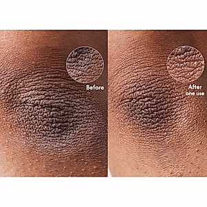 Lanolips 101 Dry Skin Super Cream - Body Cream & Face Moisturizer - Whipped Body Butter for Dry Skin - Triple Lanolin, Sweet Almond Oil, Shea Butter & Vitamin E Infused Body Care (2.02 oz)