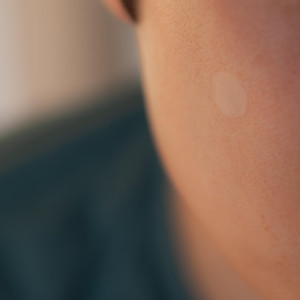 SMARTMED Cover Dot Acne Care (120 Dots) Skin Blemish Treatment with Hydrocolloid | Clear, Waterproof Patch | Oil and Pimple Absorbing | Made in USA