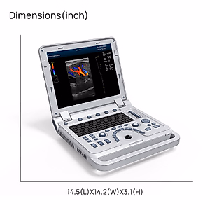 CONTEC Veterinary Ultrasound Scanner Color Doppler for Pregnancy in Animals/Goats/mare/Horses with 7.5Mhz endo-Rectal Probe