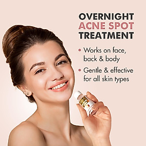 Ebanel Acne Drying Lotion, Overnight Salicylic Acid and Sulfur Cystic Acne Spot Treatment for Face and Body, Pimple Cream Spot Treatment, Dries Out Pimples, Cysts, Blemishes, Zits, and Clogged Pores