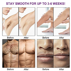 Waxing Kit for Women Men, NYANDU Wax Warmer for Hair Removal, 17.6 oz Wax Beads (5 Packs), Hard Wax Kit for Coarse Hair Facial Eyebrow Legs Armpit Bikini Brazilian, Professional Home Wax Machine