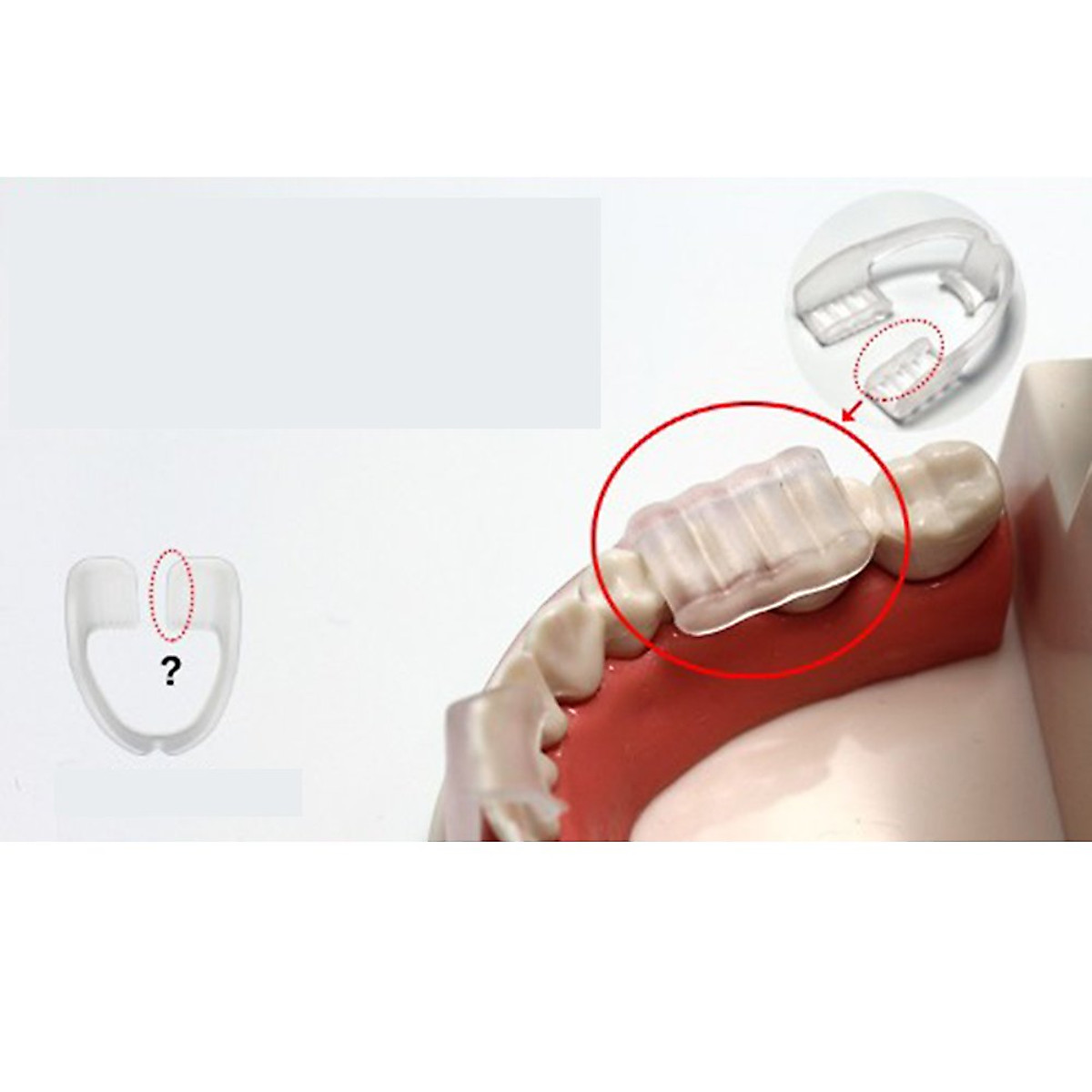 BESPORTBLE 3Pcs Dental Night Protector Dental No More Teeth Grinding Food Grade EVA Supplies for Kids (Transparent)