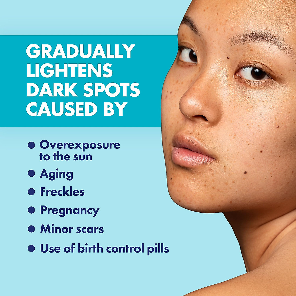 Dermisa Skin Fade Cream with Vitamin C | Helps Reduce Dark Spots and Age Spots | All Skin Types | 1.78 OZ | Pack of 3