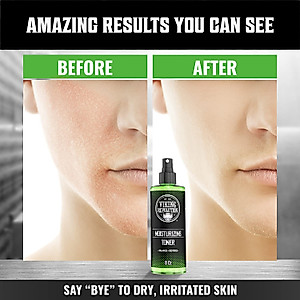 Viking Revolution Skin Toner for Men, Facial Toner Spray for Mens Face Care, Toner for Face - Hydrating Toner for Oily Skin, Balancing Toner for Sensitive Skin - Natural Facial Toner for Men (8oz)