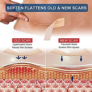 Silicone Scar Sheets (1.6” x 120” Roll-3M), Silicone Scar Tape Roll, Scar Silicone Strips, Reusable, Professional Scar Removal Sheets for C-Section, Surgery, Burn, Keloid, Acne et
