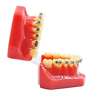 Dental Orthodontic Metal Brcket with Typodont Teeth Model