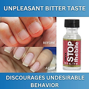 Onyx Professional Stop the Bite Nail Biting Deterrent Polish 0.5 Fl Oz - Helps Nails Grow & Can be Used as a Top or Base Coat