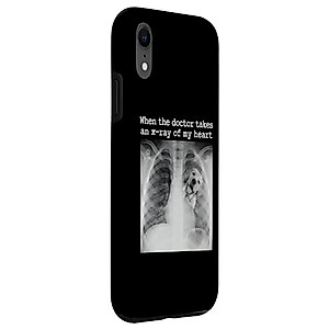 iPhone XR When The Doctor Takes an X-ray of My Heart Yellow Labrador Case
