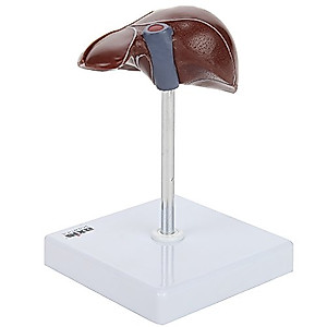 Axis Scientific Anatomy Model of Diseased Liver | Model is 1/3 Life-Size and Divides in 2 Parts | Shows 6 Liver Diseases and Abnormalities | Comes on a White Base