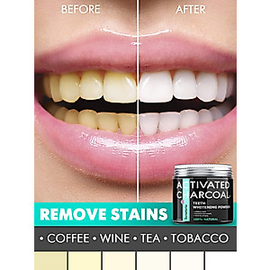 Teeth Whitening Powder - Remineralizing Tooth Powder for Tooth Whitening 5 in 1 Formula | Blanqueador de Dientes | Charcoal Toothpaste Alternative | Sensitivity Treatments