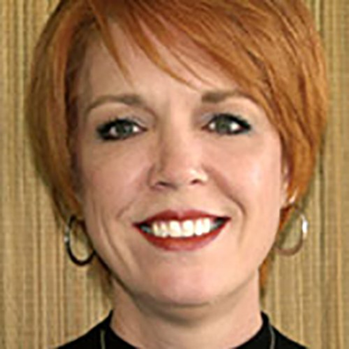 Cellulite Massage DVD - Learn The Best Anti Cellulite Treatment - This Cellulite Video Demonstrates Effective Massage Techniques for Cellulite Reduction. Learn Massage Techniques From A Professional Massage Therapist To Reduce The Appearance of Cellulite