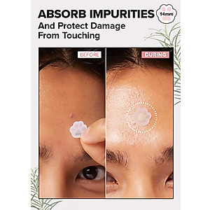 I DEW CARE Hydrocolloid Acne Pimple Patch - Timeout Blemish Chin & Chicks + Timeout Blemish Happy Paws Bundle