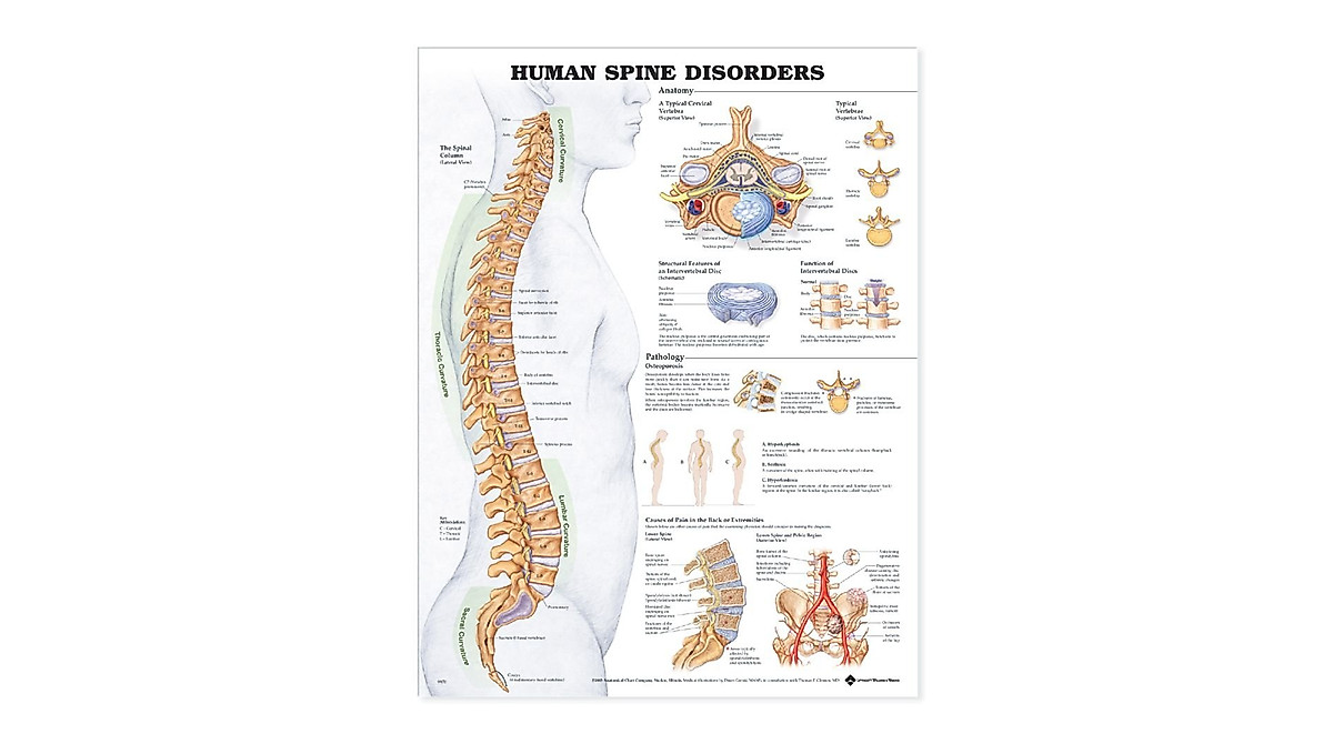 Human Spine Disorders Anatomical Chart - Detailed Medical Reference