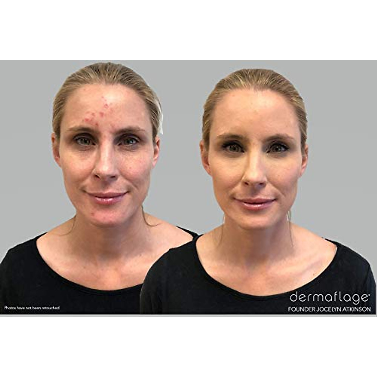 Waterproof Concealer Cream, Full Coverage Waterproof Makeup, Color Match Promise by Dermaflage, 6g/.2oz (Tan)