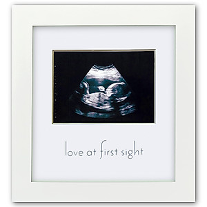 Green Pollywog | Sonogram Picture Frame | White Frame | Ultrasound Frame | Pregnancy Gifts for First Time Moms | Baby Ultrasound Picture Frame | Gifts for Parents/Grandparents | Nursery Decor