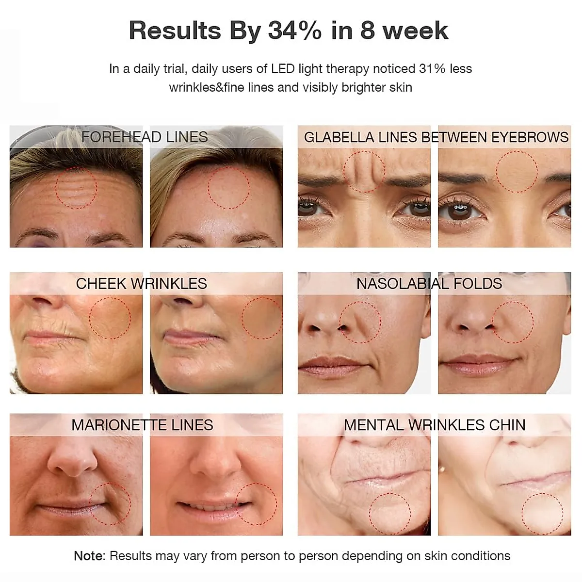 NEWKEY Red Light Therapy Mask for Face Wrinkles, 7 LED Light Therapy Facial Skin Care Mask,At-Home Photon Skin Care Beauty Mask for Anti-Ageing