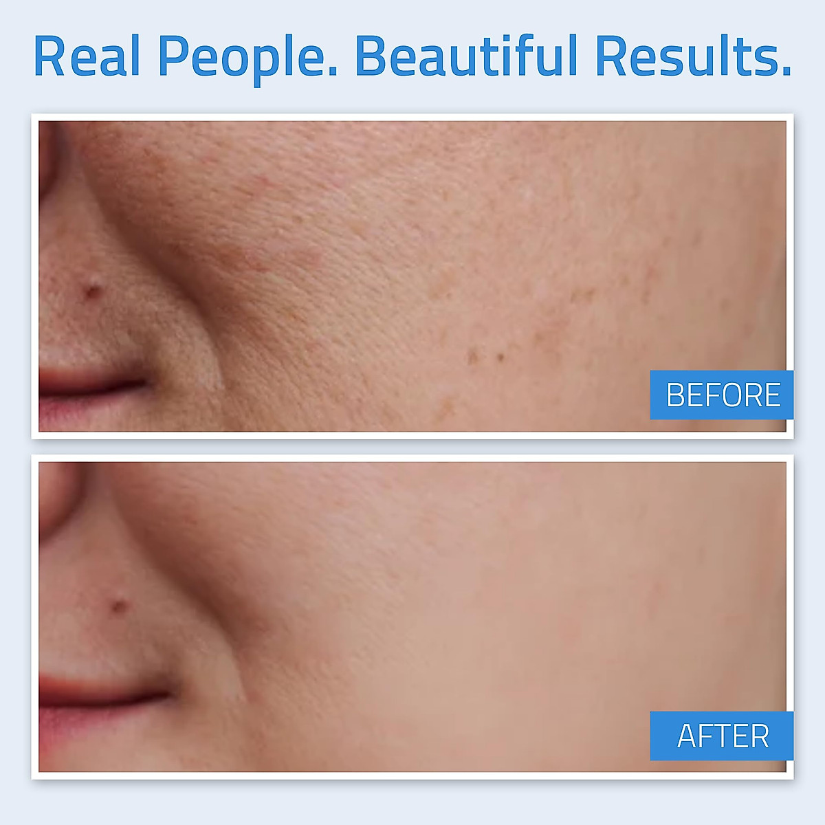 YEOUTH Regenotin Collagen Support for Skin, Nails, Hair, and Joints, Vegetarian Dietary Supplements for Men and Women, 60 Capsules