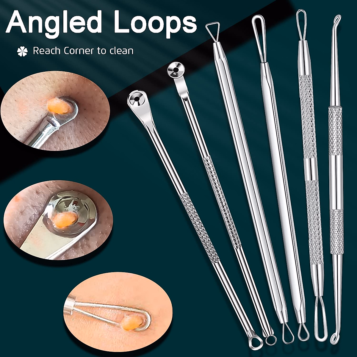 22PCS Blackhead Remover Tools, Acne Blemish Removal, Pimple Popper Extractor, Comedone Whitehead Zit Tweezers, Stainless Steel with Metal Case