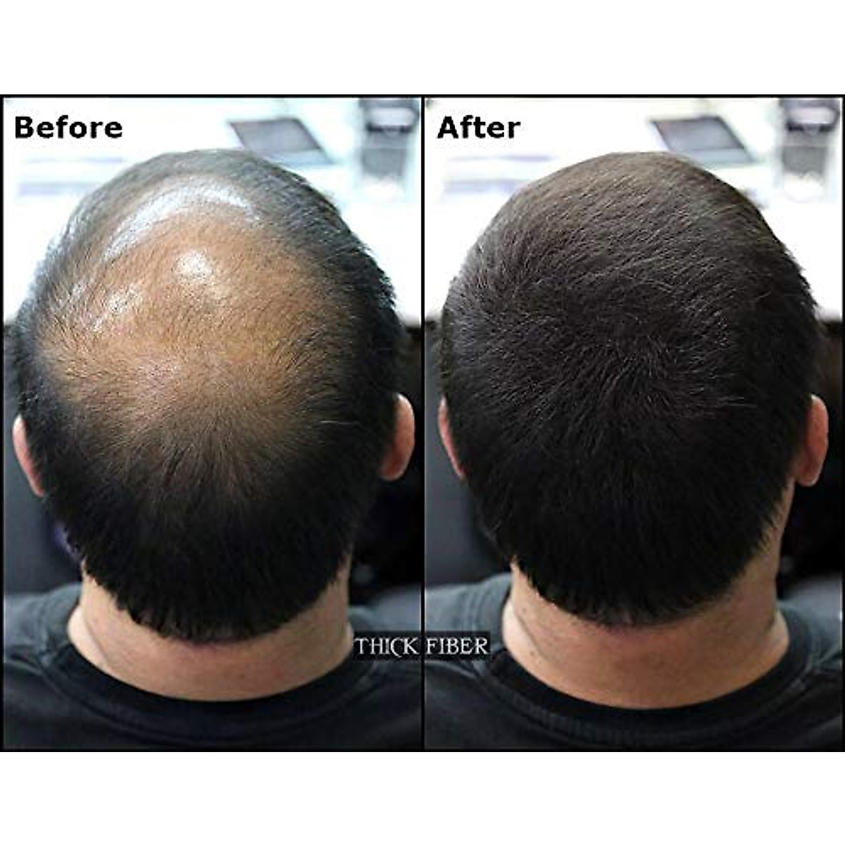 THICK FIBER Hair Fibers for Thinning Hair & Bald Spots (BLACK) - 25g Bottle - Conceals Hair Loss in Seconds - Hair Powder for Women & Men