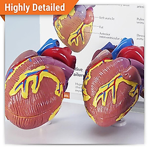 Heart Model Set | Human Body Anatomy Replica Heart Disease Set for Doctors Office Educational Tool | GPI Anatomicals