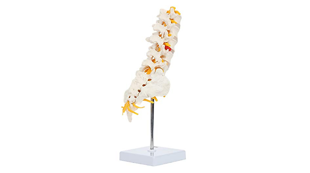 Lumbar Spine Anatomy Model with Nerves & Herniated Disc | Axis Scientific