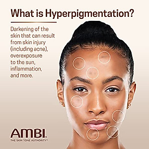 Ambi Even & Clear Advanced Fade Cream, Hydroquinone-free, Hyperpigmentation Treatment, Stubborn Dark Spot Corrector, Results In As Little As 2-3 Weeks, Niacinamide, Licorice Root Extract, PHA, 1 Fl Oz