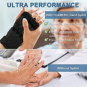 Feamero Radial Nerve Palsy Splint, Adjustable Finger Lift Elastic Strap Arm Brace Splint for Drop Wrist, Radial Nerve Injury, Mcp Arthroplasty, Finger Injury Arthritis, Unisex Fit Left & Right Hand