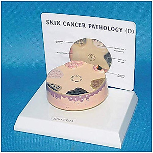 Anatomy Model Human Skin - Skin Enlarged Anatomy Model - Medical Anatomical Skin Structure Model Medical Teaching Model - for Medical Educational Aid