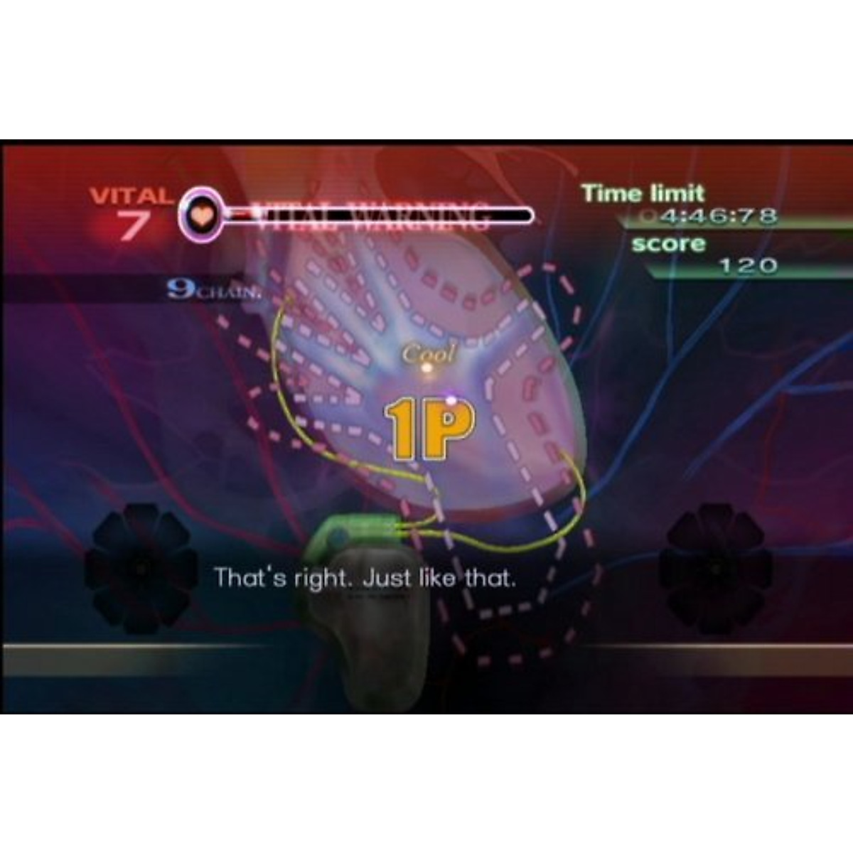 Trauma Center: New Blood - Nintendo Wii (Renewed)