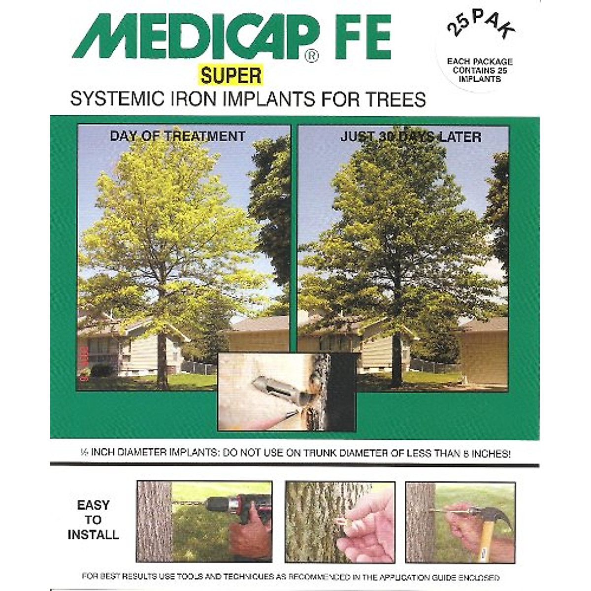 Medicap 25-Pack FE SUPER Systemic Iron Tree Implants for Control of Iron Chlorosis, 1/2-Inch