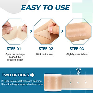 Silicone Scar Sheets, Silicone Scar Tape(1.6”x 60” Roll-1.5M), Silicone Scar Strips, Professional Scar Removal Sheets for Surgical Scars, Keloid, C-Section, Burn et