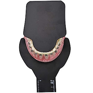 Oral Photo Background Plate, Dental Photo Background Plate Autoclaved Orthodontic Teeth Comparison Intraoral Photo Beijing for Taking Oral Photo Black (6 Pcs) Dental Photo Comparison Board Intraoral