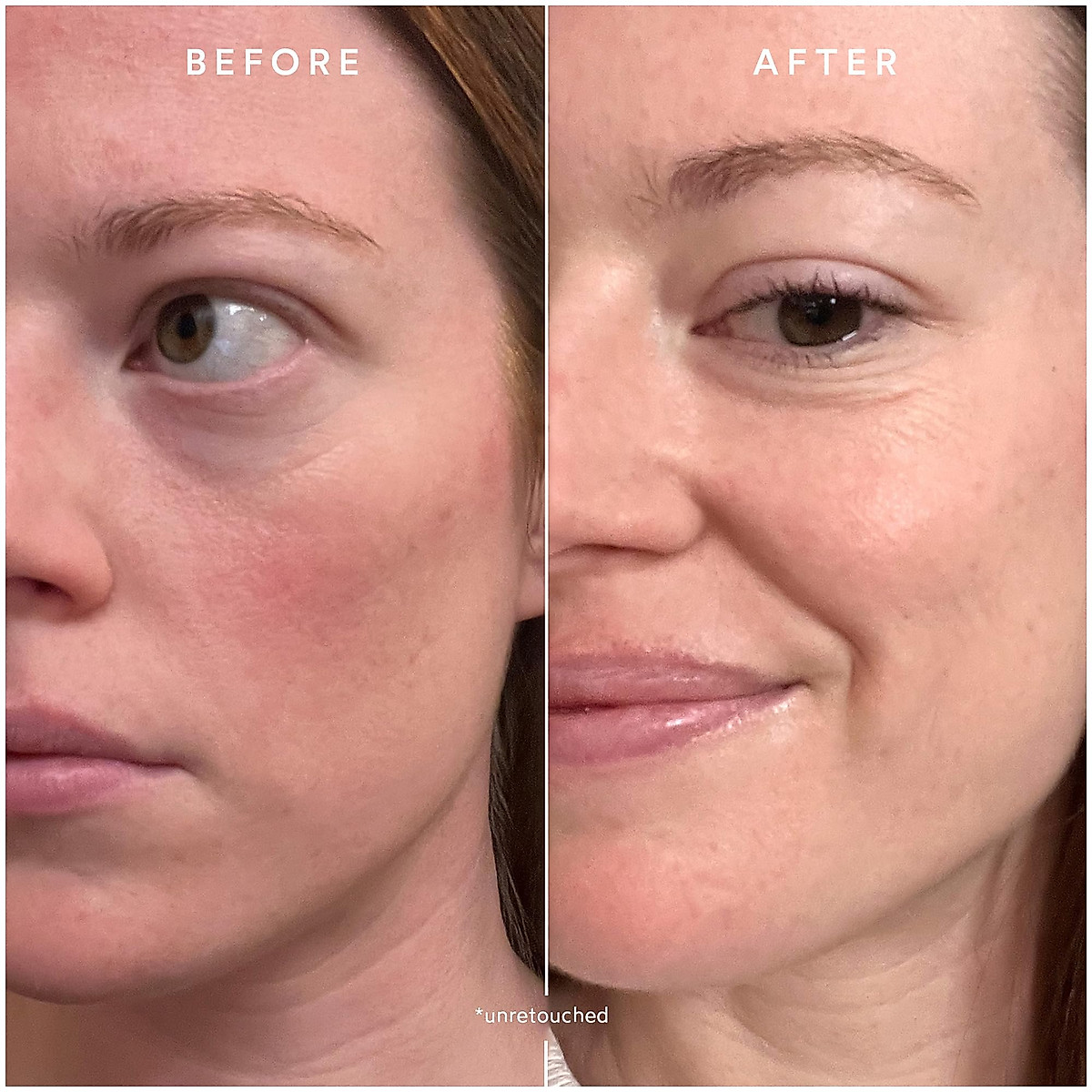 True Botanicals Chebula Extreme Cream | Anti-Aging Moisturizer w/Hyaluronic Acid | Treats Fine Lines & Wrinkles | Dry & Sensitive Skin | Dermatologist Tested, All Natural, Vegan | 1.7 oz | 50 ml