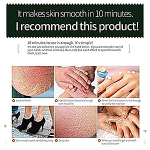 Epielle Moisturizing Hand & Foot Masks (Glove & Socks 12pk) for Dry Hand, Dry & Cracked heel Spa Masks Sunflower Seed Oil + Avocado Oil + Vitamin E