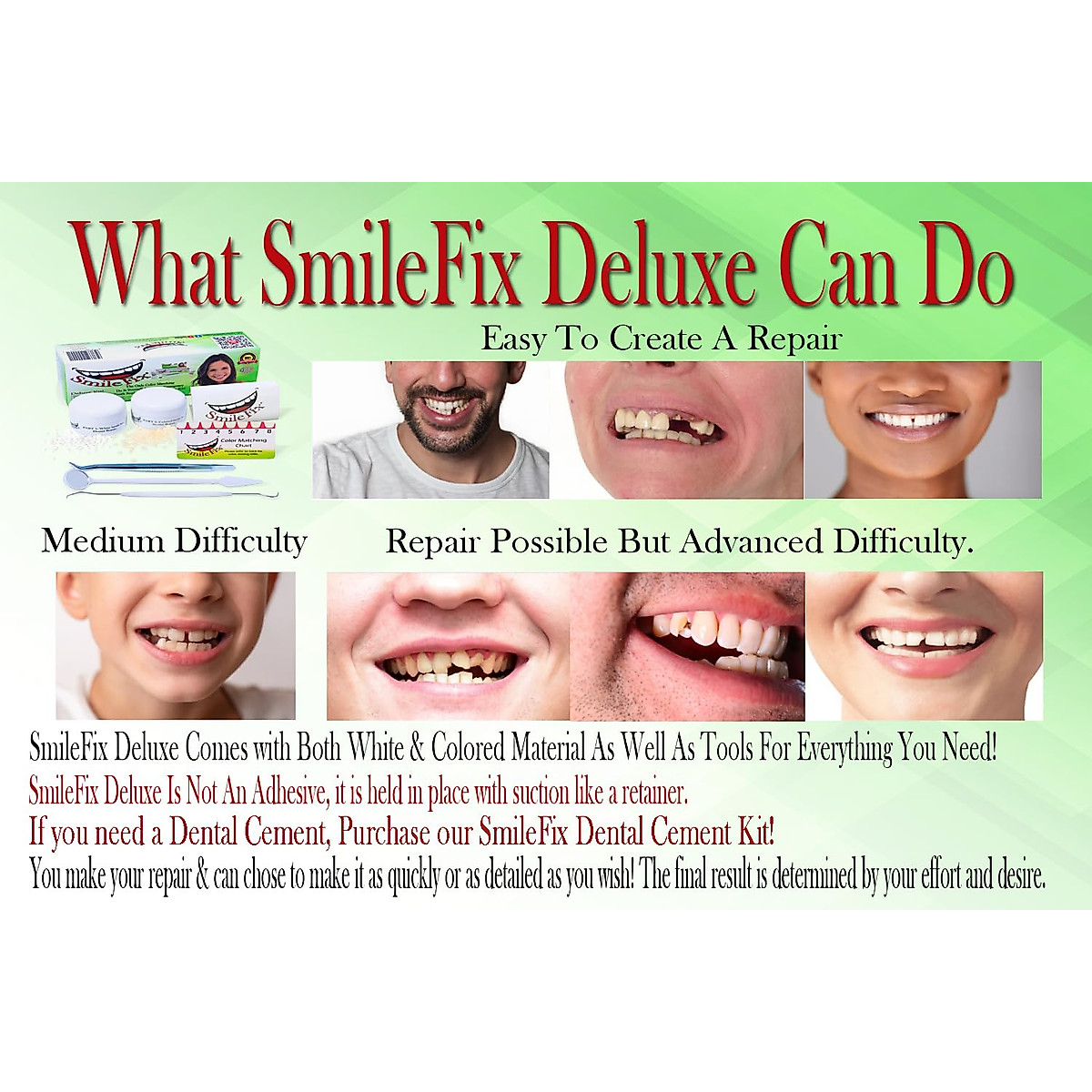 SmileFix Deluxe Dental Repair Kit - Color Matching Compound - Includes Tools - Missing Or Damaged Teeth - Fix Gaps, Broken Teeth - Durable Tooth Repair - Fast & Easy Process